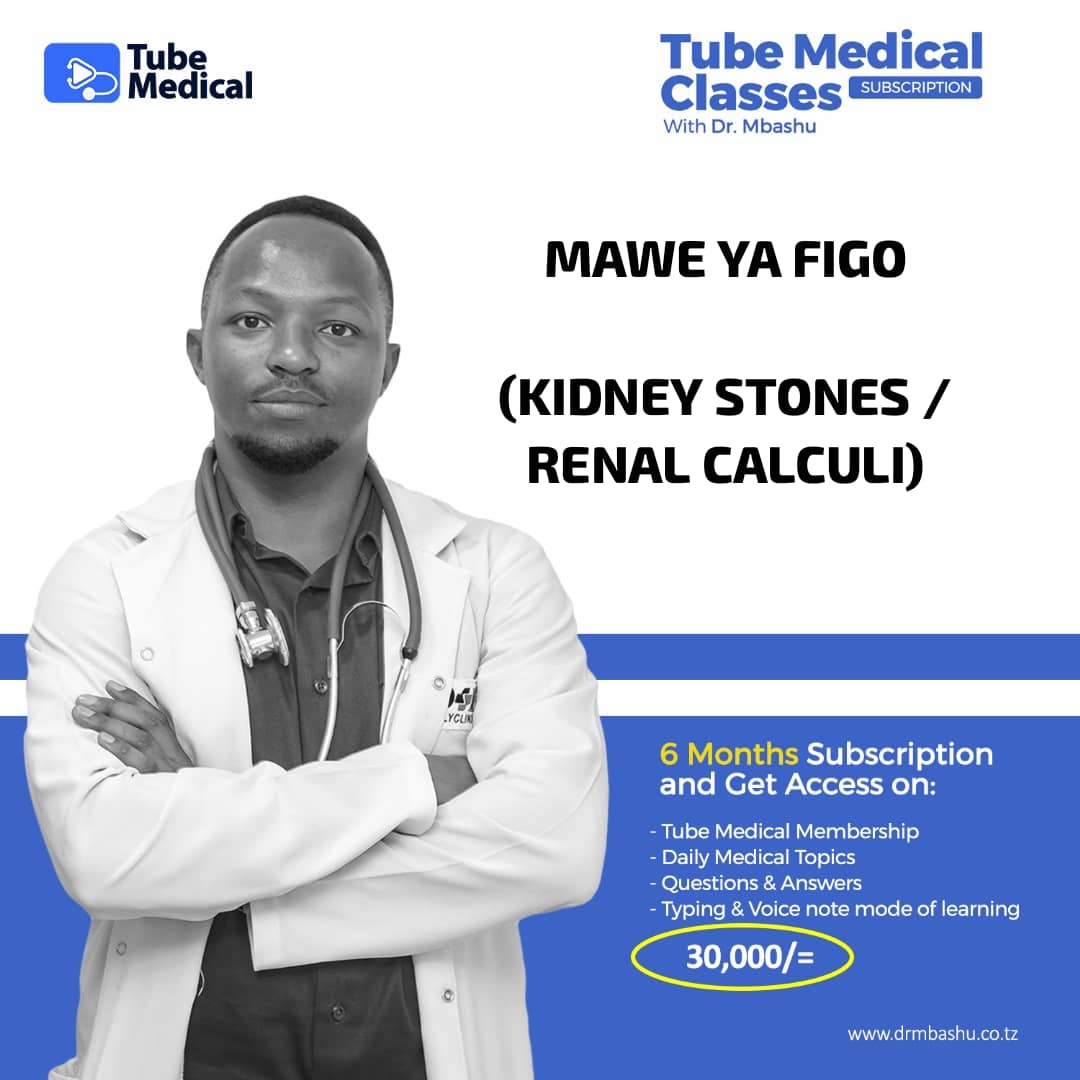 Mawe ya Figo (Kidney Stones) - Tube Medical